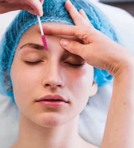 Broken Capillary Vbeam In Korea Cost Procedure Recovery And Best Clinics