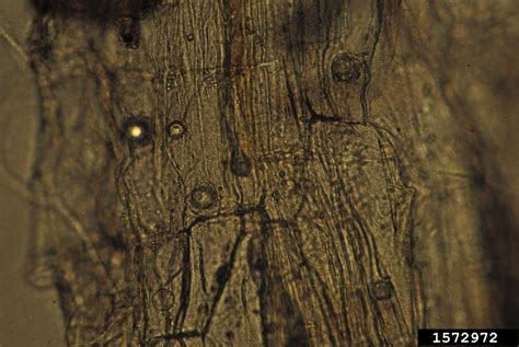 Pythium Diseases Genus Pythium