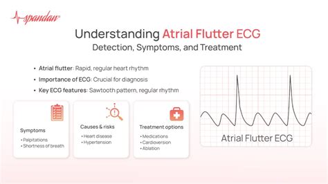 Decoding Atrial Flutter ECG Symptoms Treatment And Risk