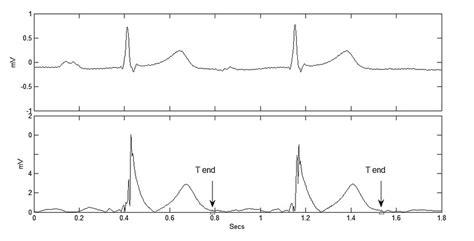 7 t wave end detection ecg trace top trace and rectified