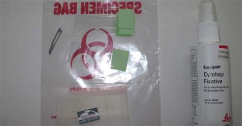 Preparing A Tzanck Smear Image