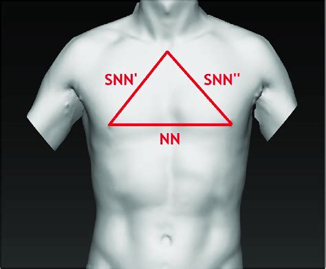 Depiction Of Snn And Nn Download Scientific Diagram