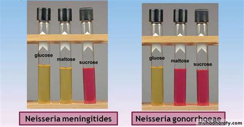Nesseria Pptx D Faten Muhadharaty