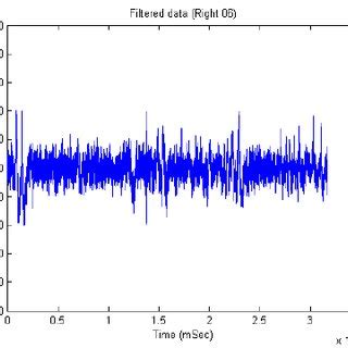 D EEG Image Named Spectrogram Is In Time Frequency Domain An Example Download Scientific