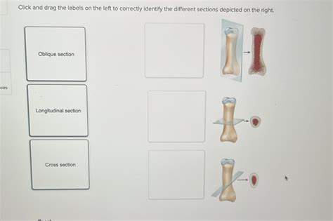 Solved Click And Drag The Labels On The Left To Correctly Identify The Different Sections