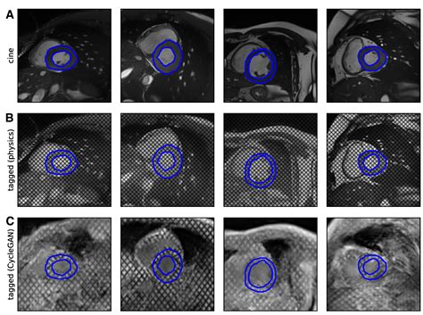 Bioengineering Free Full Text Myocardial Segmentation Of Tagged Magnetic Resonance Images
