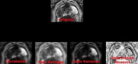 10 Examples Of Image Features Extracted From Glcm Download Scientific Diagram