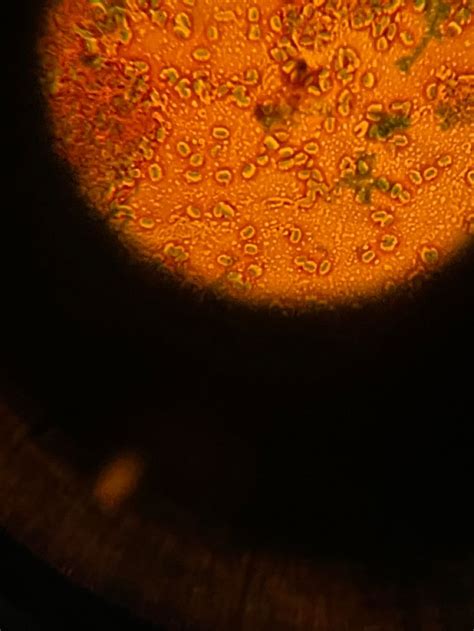 Endospore Formation In Bacteria