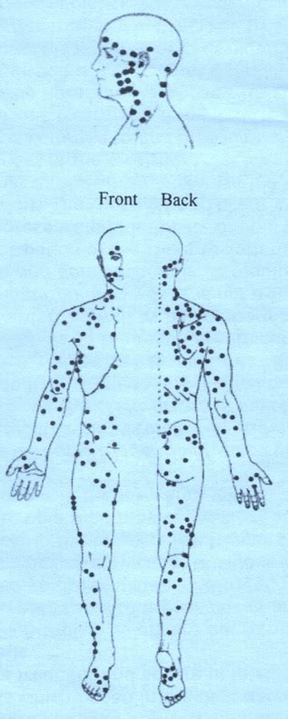 How Trigger Point Massage Therapy Works In Technical Terms Best