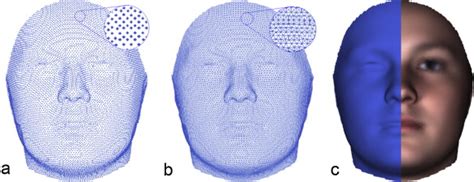 Improved Facial Outcome Assessment Using A 3d Anthropometric Mask Pocket Dentistry