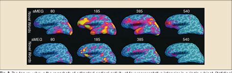 Figure 1 From Integration Of Eeg Meg With Mri And Fmri Semantic Scholar