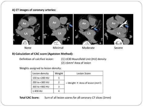 Ct Calcium Score Pptx
