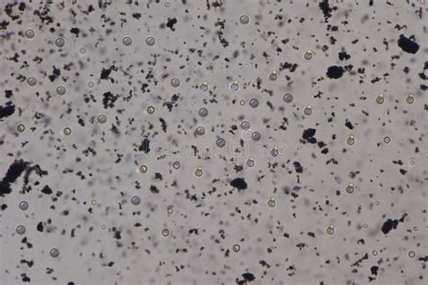 Cryptococcus Neoformans Is An Encapsulated Yeast India Ink Preparetion Stock Image Image Of