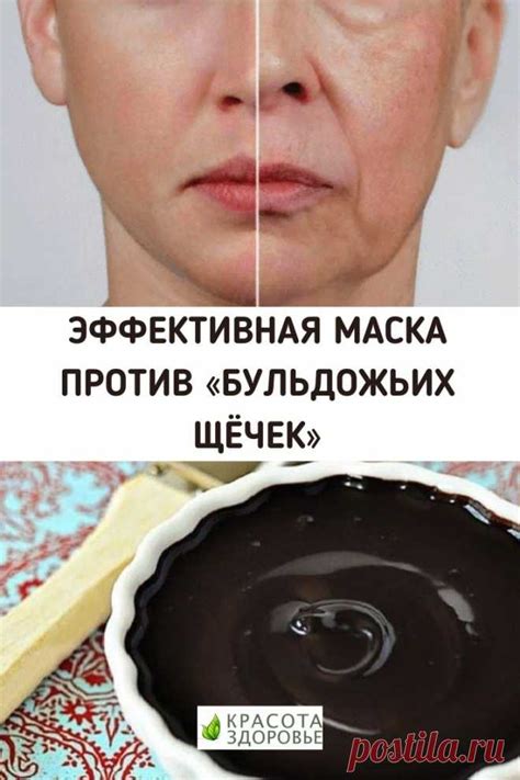 Эффективная маска против «бульдожьих щёчек Хорошо убирает отвислос Маски для лица Постила