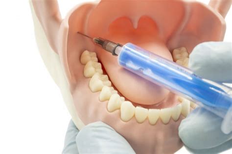 Mandible For Mandibular Anesthesia Training Biovoxel Technologies