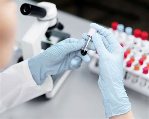 Syphilis Test And Example Free Pdf Download
