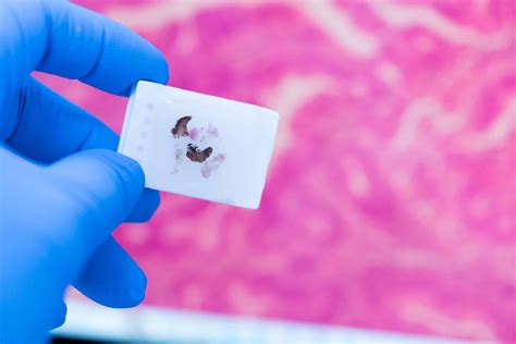 Formalin Fixed Paraffin Embedded Ffpe Tissue Logical Biological