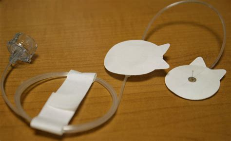 Excited About The Omnipod 5 And Dexcom G6 Closed Loop System Island In The Net