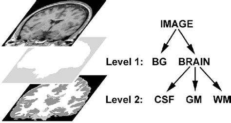 Figure 1 From Anatomical Guided Segmentation With Non Stationary Tissue
