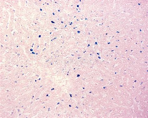 Liver Kuppfer Cell Labelled Stock Image Image Of Sinusoid Blue