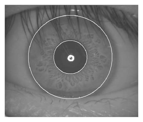 steps involved in preprocessing a original iris image b roi