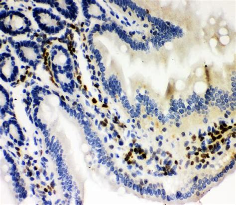 Anti Runx1aml1 Antibody Picoband™ Bosterbio