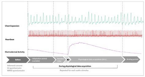 effects of industrial noise on physiological responses