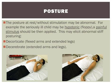 Pediatric Assessment Triangle Ppt First Aid Injuries