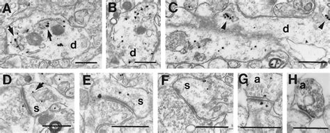 Electron Micrographs Demonstrating Fmrp Localization In Cellular Download Scientific Diagram