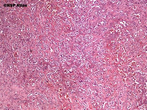 Hsp Atlas Histopathology Atlas Endocrine