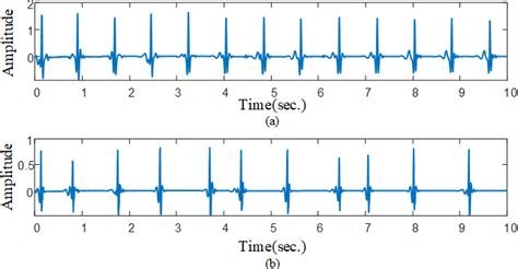 figure 1 from an automated approach for atrial fibrillation detection