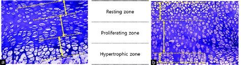 Distinct Zones Of Spheno Occipital Synchondrosis And Tibia Cartilage Download Scientific