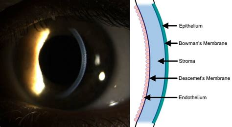 Cornea Location And Anatomy The Cornea Is The Anterior Refractive Download Scientific Diagram