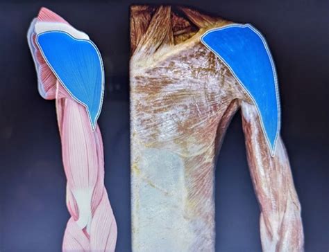 Skeletal Muscles Of The Arm Flashcards Quizlet