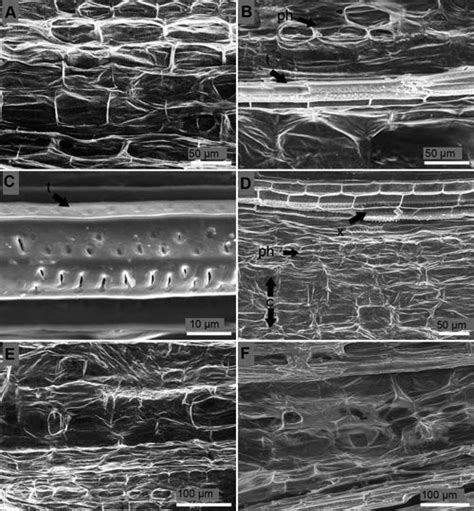 Longitudinal Section Of The Stem Of P Edulis F Flavicarpa Seedlings Download Scientific