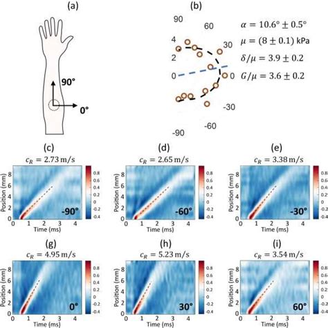 An Example Of In Plane Anisotropy Of Rayleigh Wave Propagation In Skin
