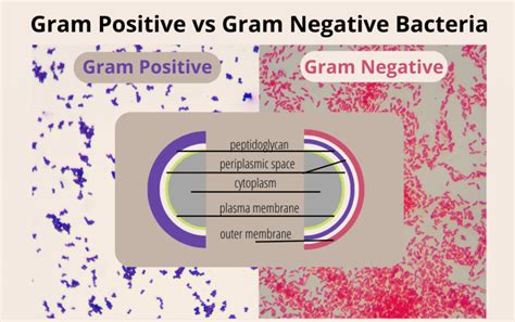 Difference Between Gram Positive And Gram Negative Bacteria