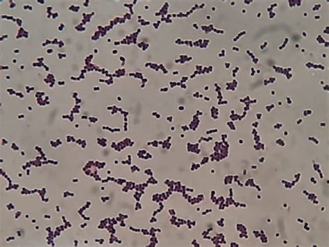 Staphylococcus Sciuri Introduction Morphology Pathogenicity Staphylococcus Sciuri Introduction Morphology Pathogenicity