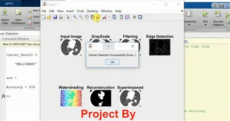 Lung Cancer Detection Using Image Processing Matlab Source Code ~ Matlab Projects
