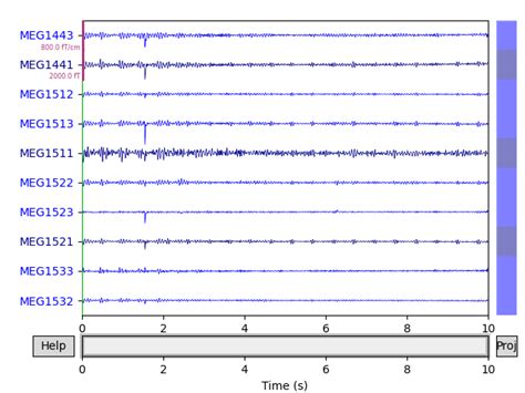 Plot Sensor Denoising Using Oversampled Temporal Projection — Mne 0212 Documentation