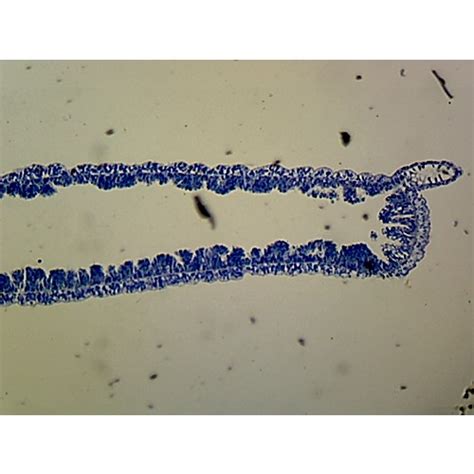 Prepared Microscope Slide Hydra Ls
