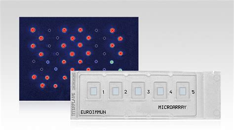 Euroarray Hpv Test For Individual Cancer Prevention Euroimmunblog