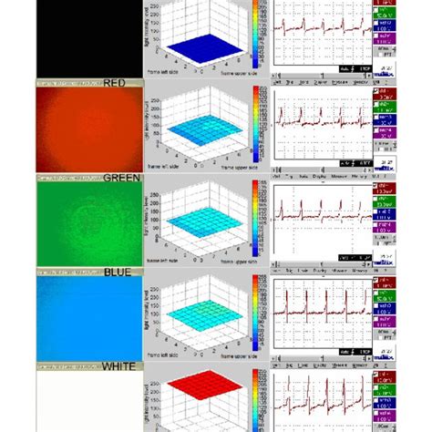 Oscilloscope Traces Of The Monophasic Waveforms Corresponding To The