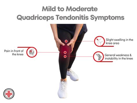 The Best Knee Brace For Quadriceps Tendonitis Relief