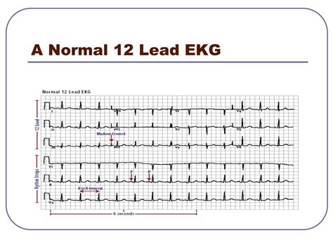 PPT - Cardiac Review PowerPoint Presentation, free download - ID:4452648