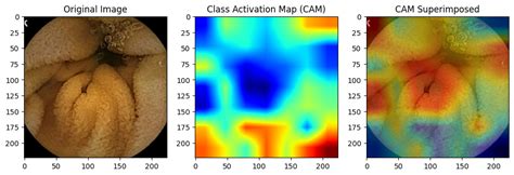 Github Akashkalasagondauto Wcebleedgen Challenge