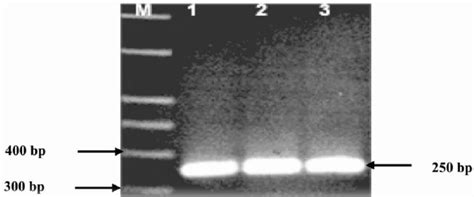Detection Of Microcystin Producing Microcystis Spp By Amplification Of Download Scientific