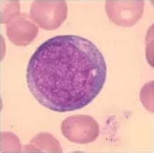 Proeritroblasto Buscar Con Google Eritropoyesis Pinterest Search