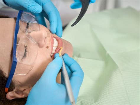 Ipr What Exactly Does It Feel Like [invisalign Wearer]