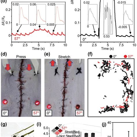 Temperature‐sensing Characteristics In An Artifact‐free Zone A Photo